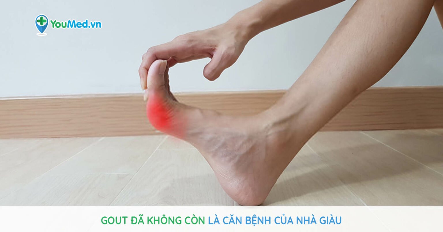 Nổi hạch ở tay và chân là dấu hiệu của những bệnh lý nào? - YouMed