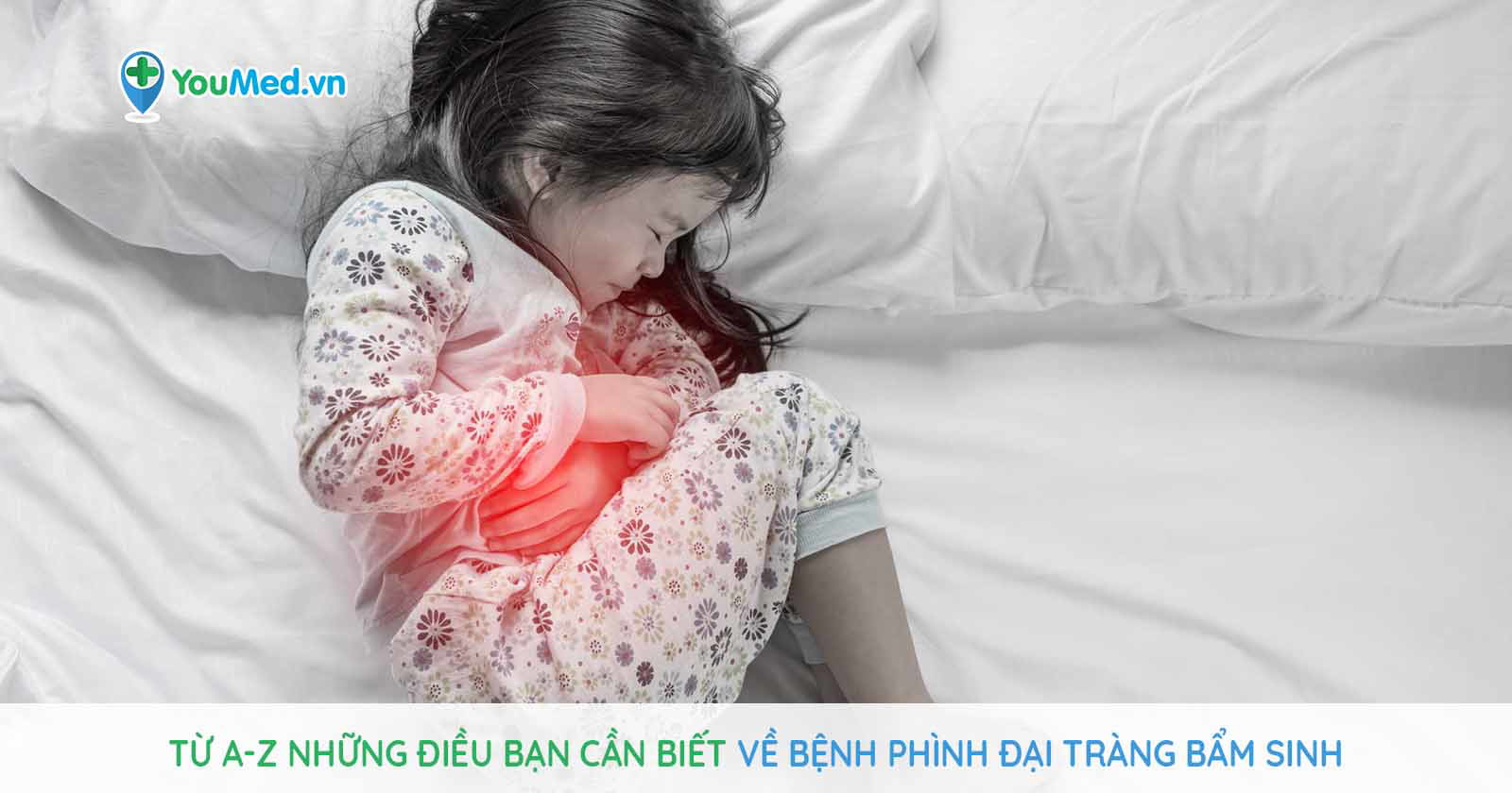 Bệnh phình đại tràng bẩm sinh (Hirschsprung): nguyên nhân, triệu chứng và cách điều trị