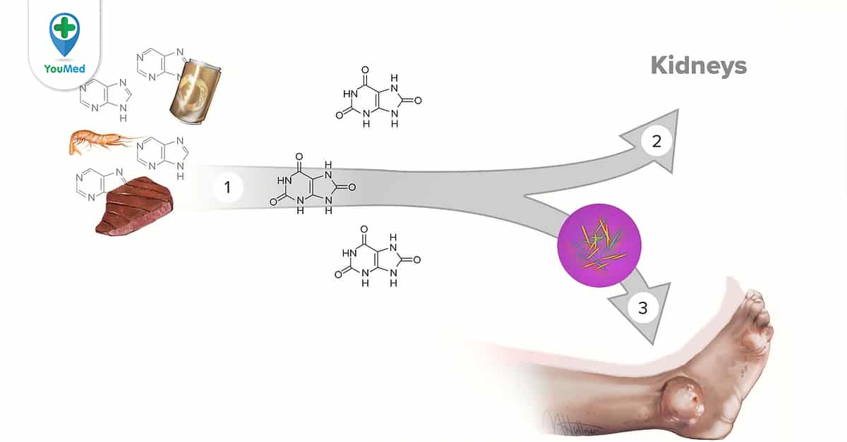 Purin là gì? Nó tác động thế nào đến sức khỏe chúng ta?