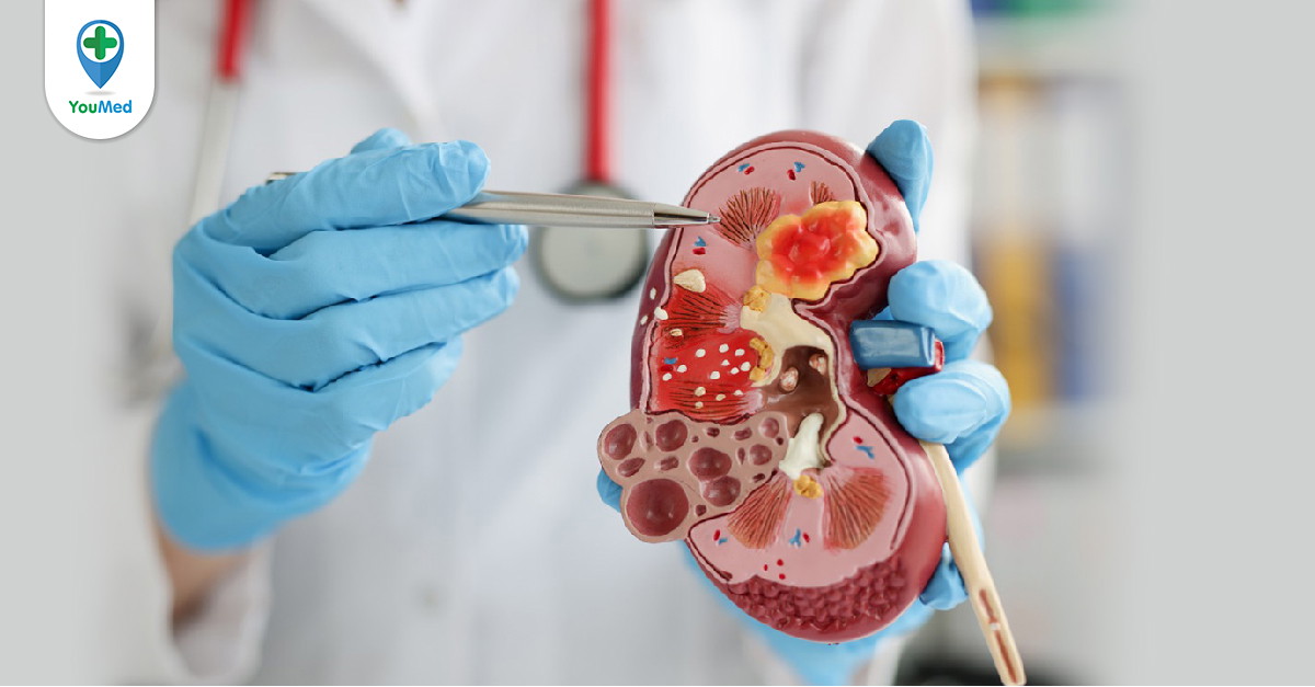 Xét nghiệm PAP là gì và quy trình xét nghiệm PAP smear như thế nào?