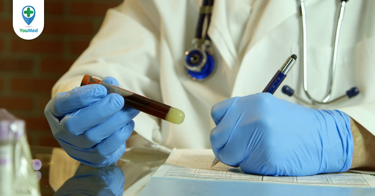 Xét nghiệm Cyfra 21-1 là gì? Ý nghĩa chỉ số xét nghiệm Cyfra 21-1 trong ...