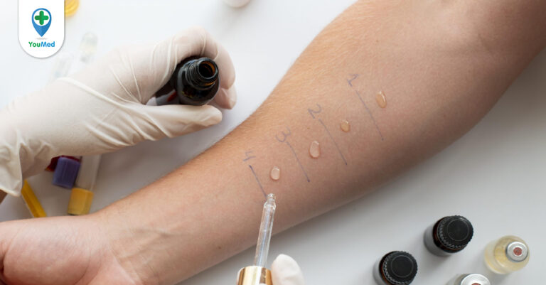 Clo test là gì? Chỉ số trong xét nghiệm HP