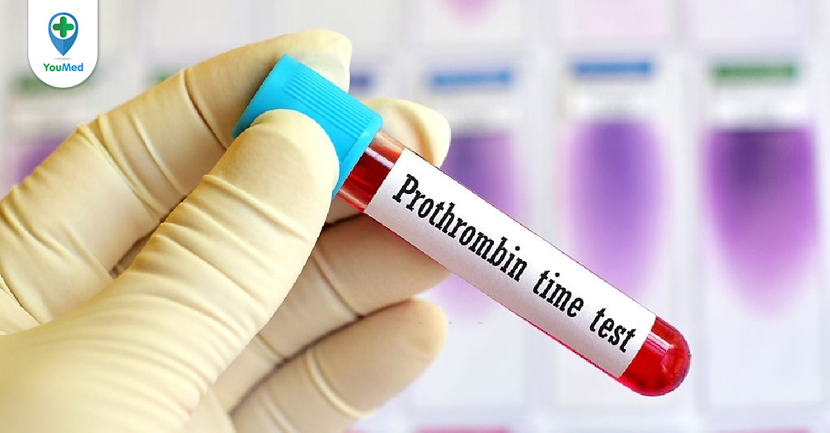 Xét nghiệm PAP là gì và quy trình xét nghiệm PAP smear như thế nào?