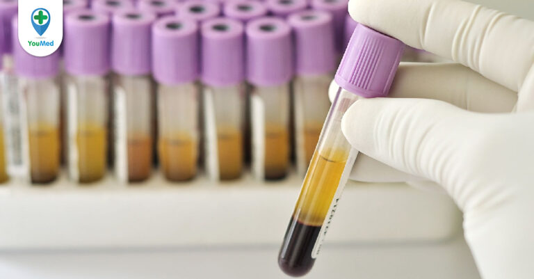 Clo test là gì? Chỉ số trong xét nghiệm HP